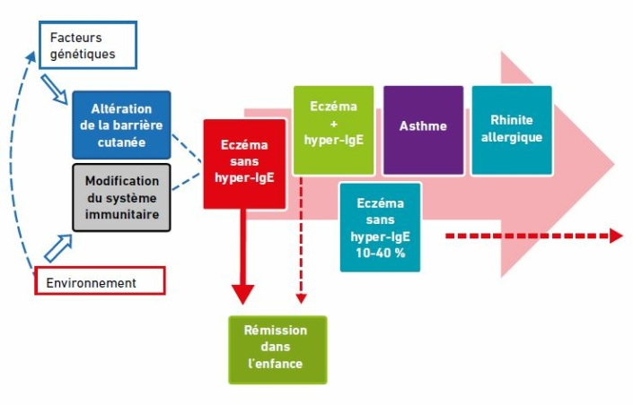 Physiopathologie de l'eczéma atopique - Reso dermatologie