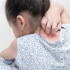 Les différents types de psoriasis - Reso dermatologie